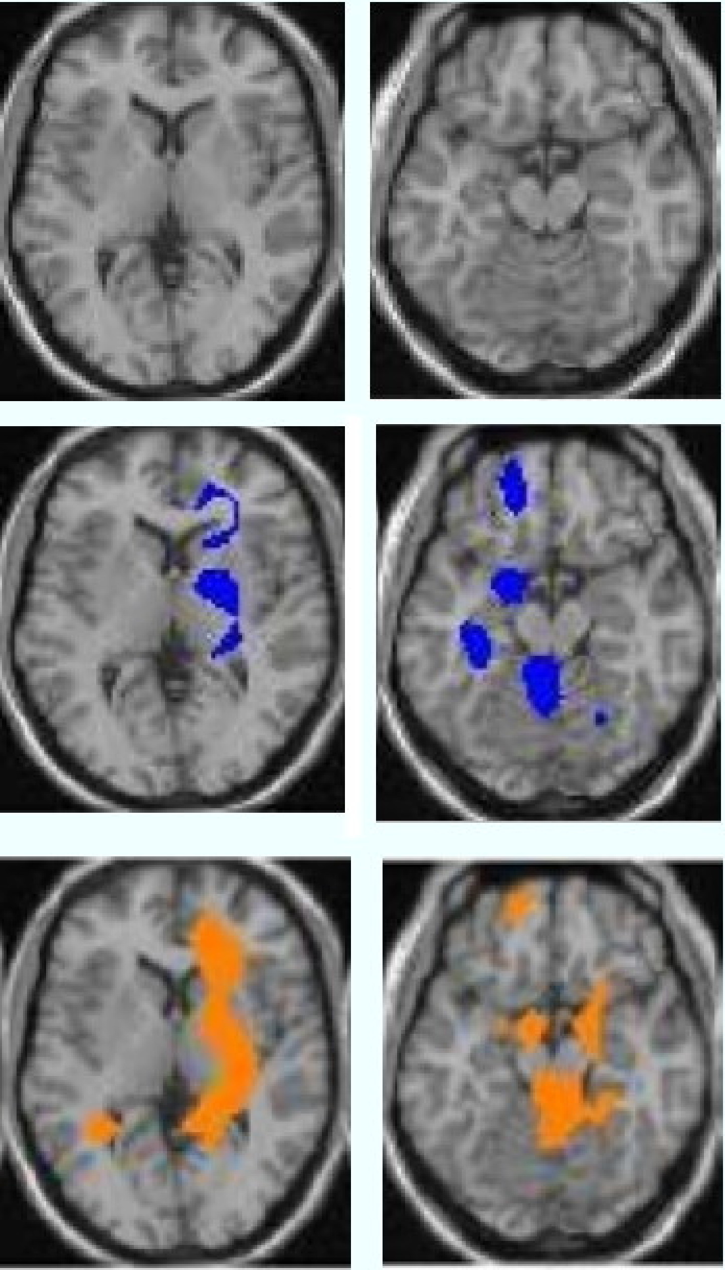 Control Your Hunger? Study Shows Men Can, Women Can't | BNL Newsroom