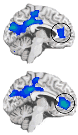 Brain-Behavior Disconnect in Cocaine Addiction | BNL Newsroom