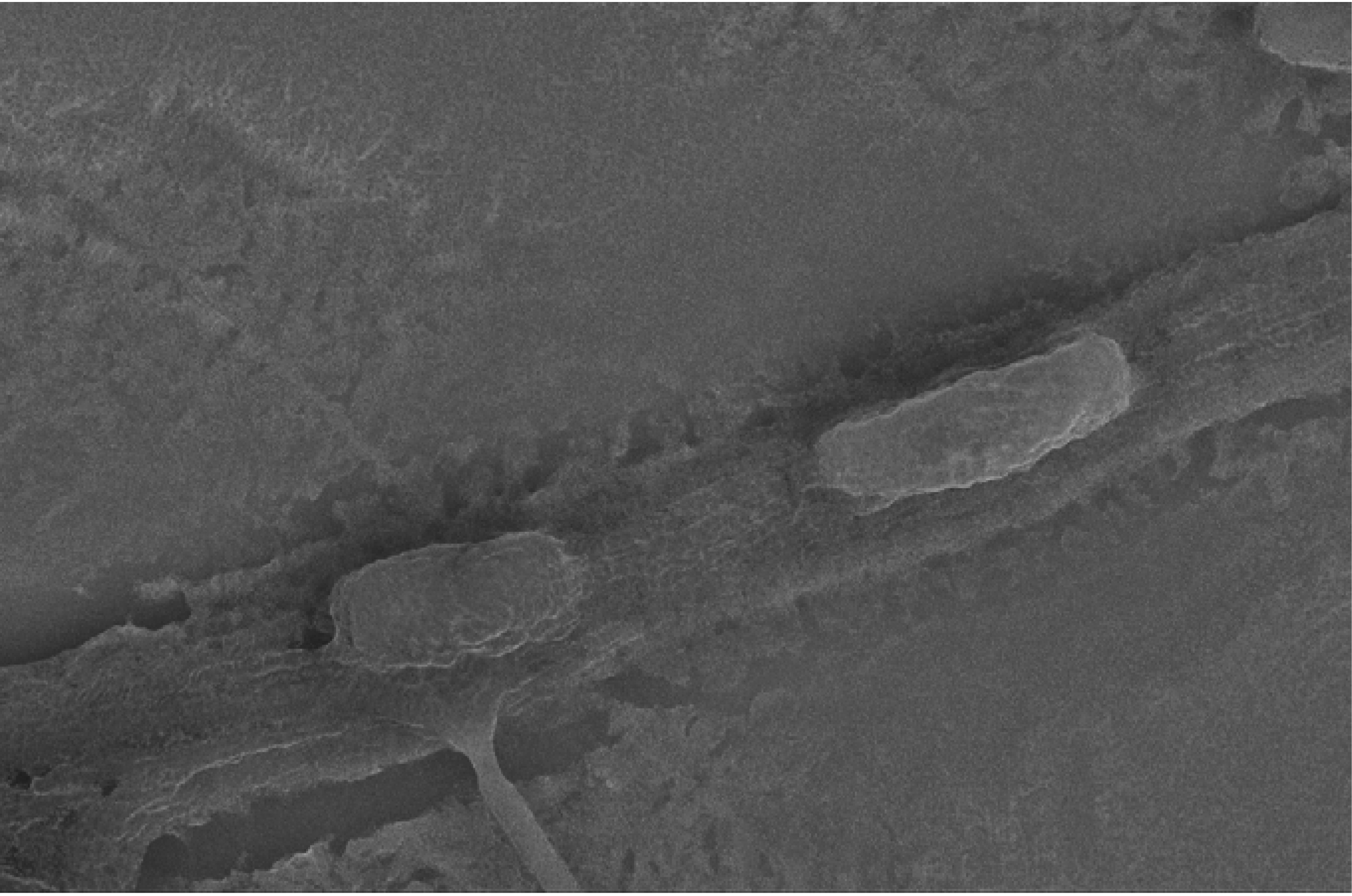 Trapped! Scientists Immobilize Bacteria in Fibrous Hydrogel | BNL Newsroom